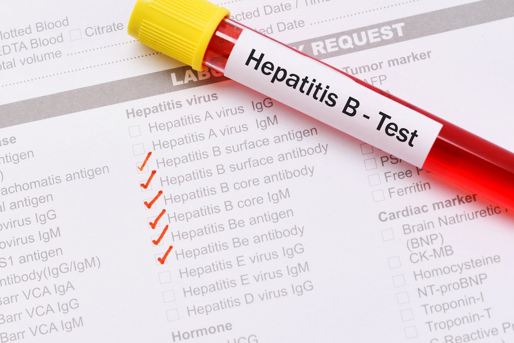 Si Mi Pareja Tiene Hepatitis B Me Puede Contagiar Deals | emergencydentistry.com